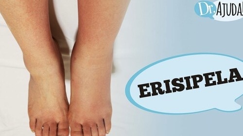 Erisipela: Entenda causas, sintomas e tratamento dessa infecção de pele ...